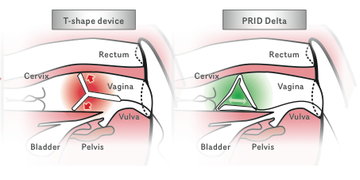PRID DELTA / Products / Reprodaction